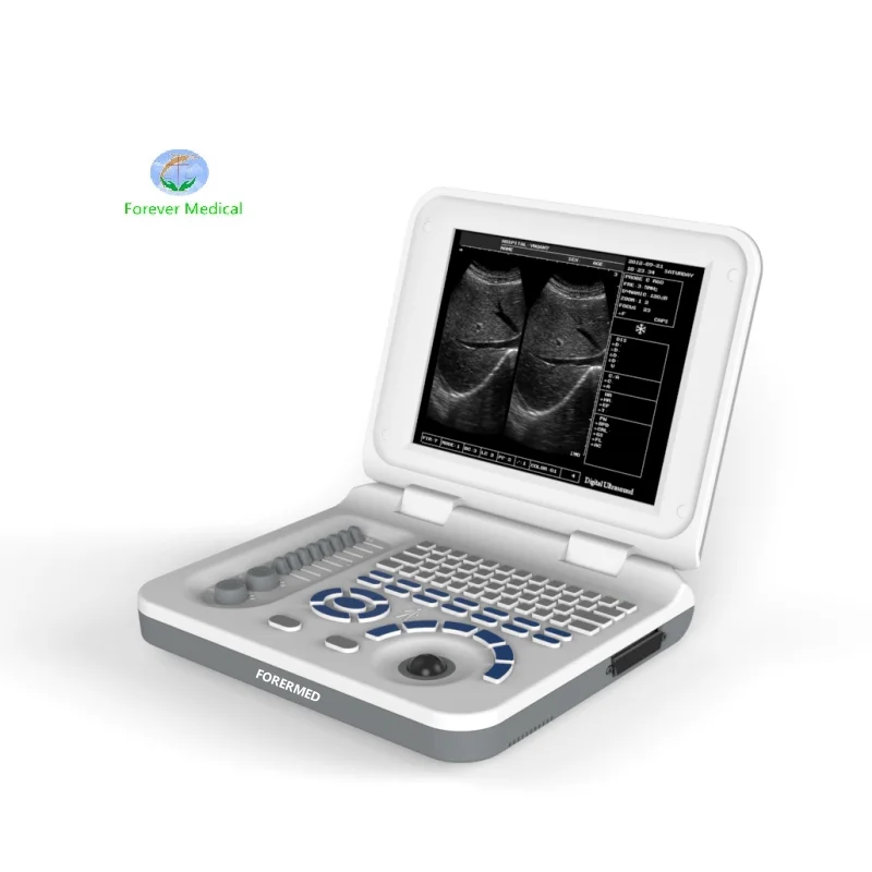 Hospital Laptop Ultrasound 10 Inch Screen Ultrasound Scranner Black And ...