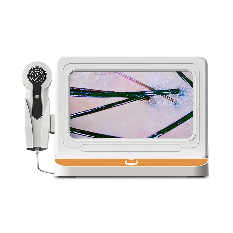 Hair Follicle Scalp Scanner - HD Analysis for Home & Commercial