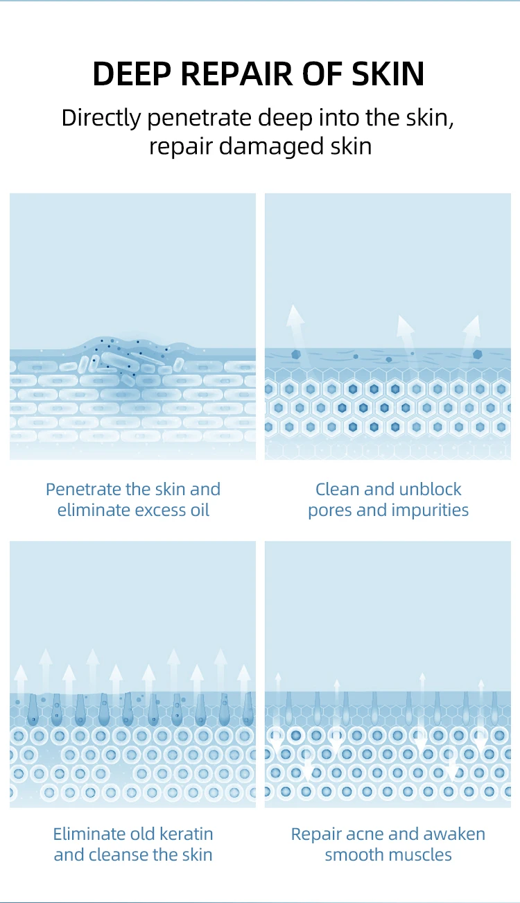 MOOYAM Acne Treatment Gel - Deeply Clean & Unclog Pores