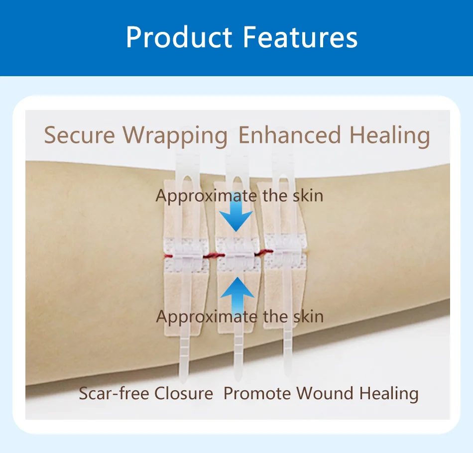Stitch Free Emergency Wound Closure Device - Konlida