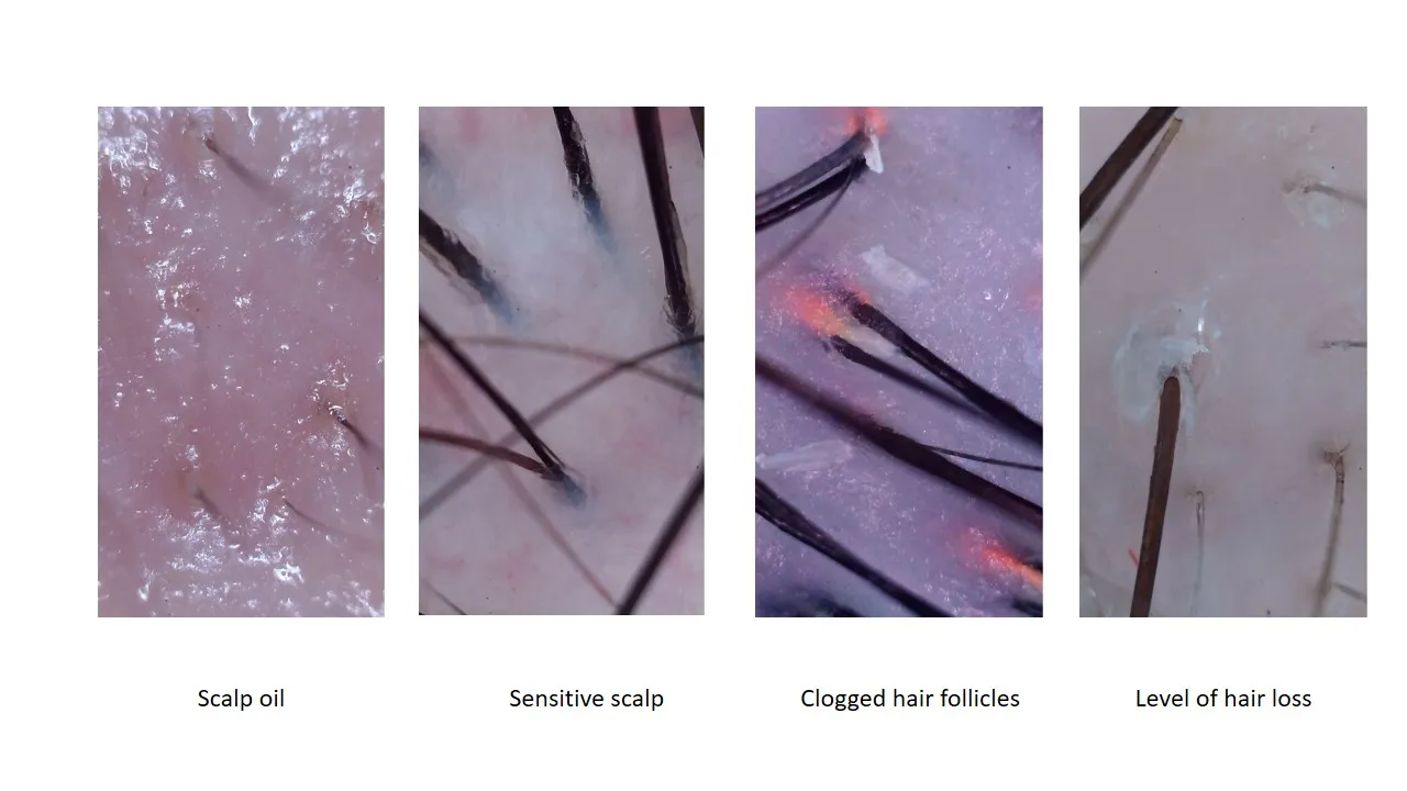 DJM Scalp Analyzer Camera Wifi Detector Portable Digital Microscope ...