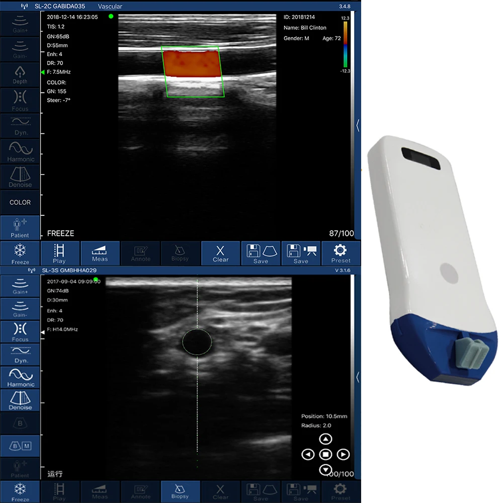 Suresult Beijing Konted's Convex & Transvaginal Probe 3-in-1 Doppler ...