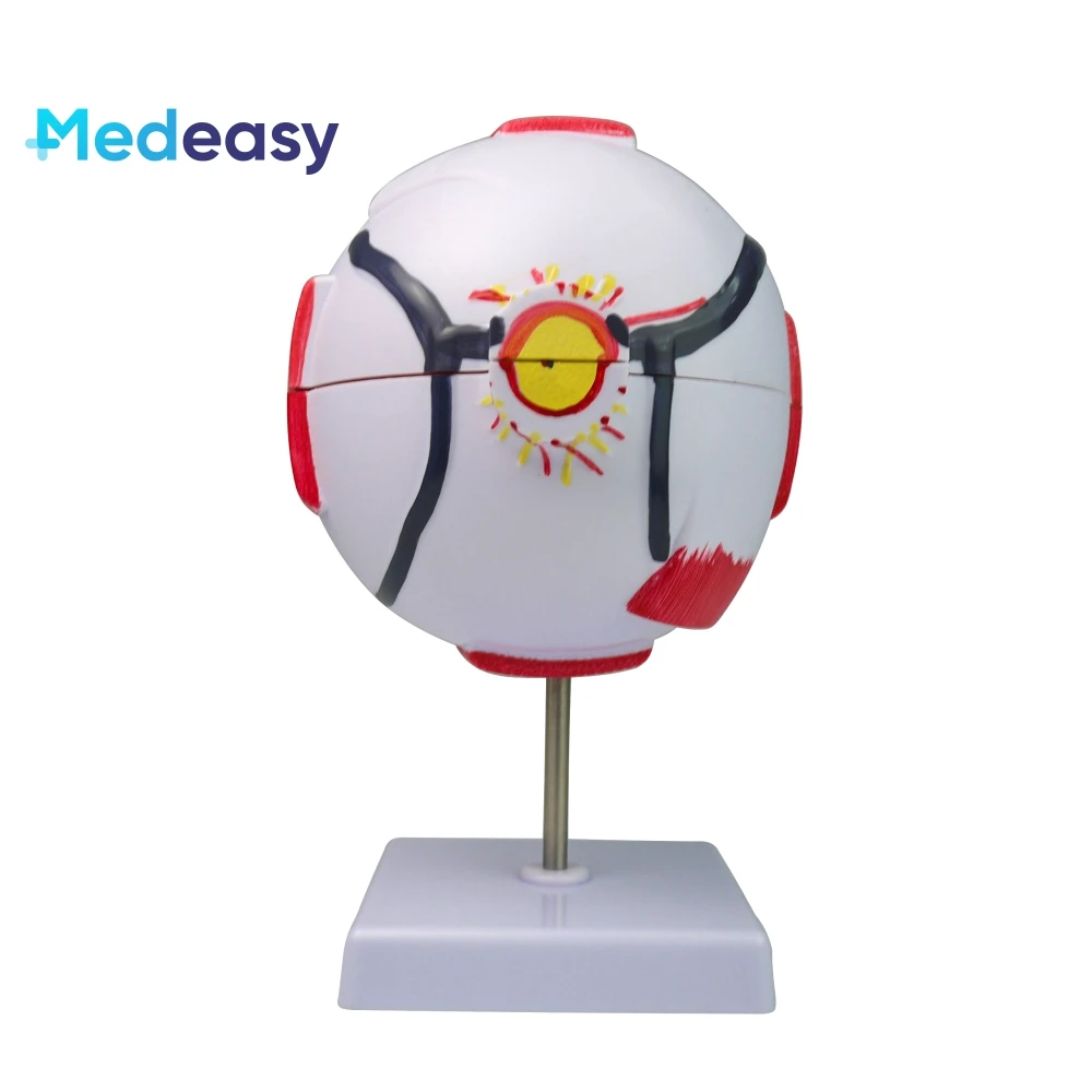 Human Eye Model 6x Magnified Eyeball Model, Eye Structure and Anatomy ...