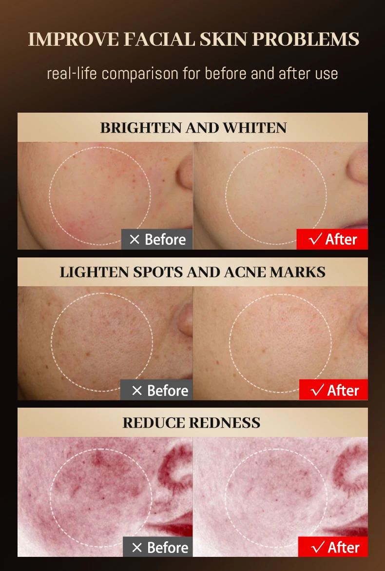 Milk Light Black Gold Beauty Instrument Facial Brightening Instrument ...