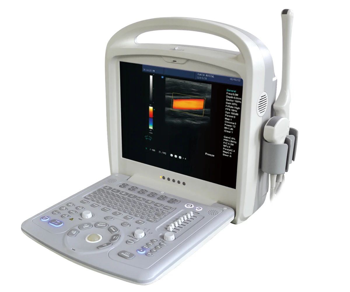 Medical Equipment Kr-c60 Portable Ultrasound Machine Color Doppler ...