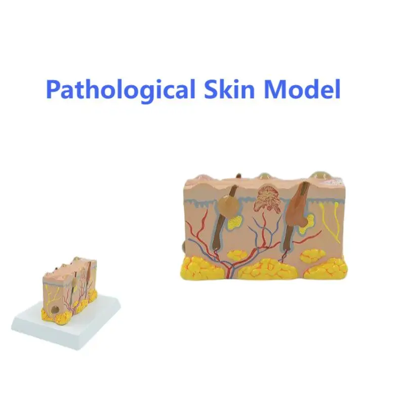 Pathological Skin Anatomical Model for Educational Equipment Human Skin ...