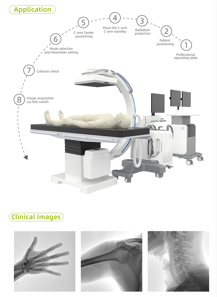 Hospital Medical 15kw Dsa Mobile Digital C Arm X Ray Machine For ...