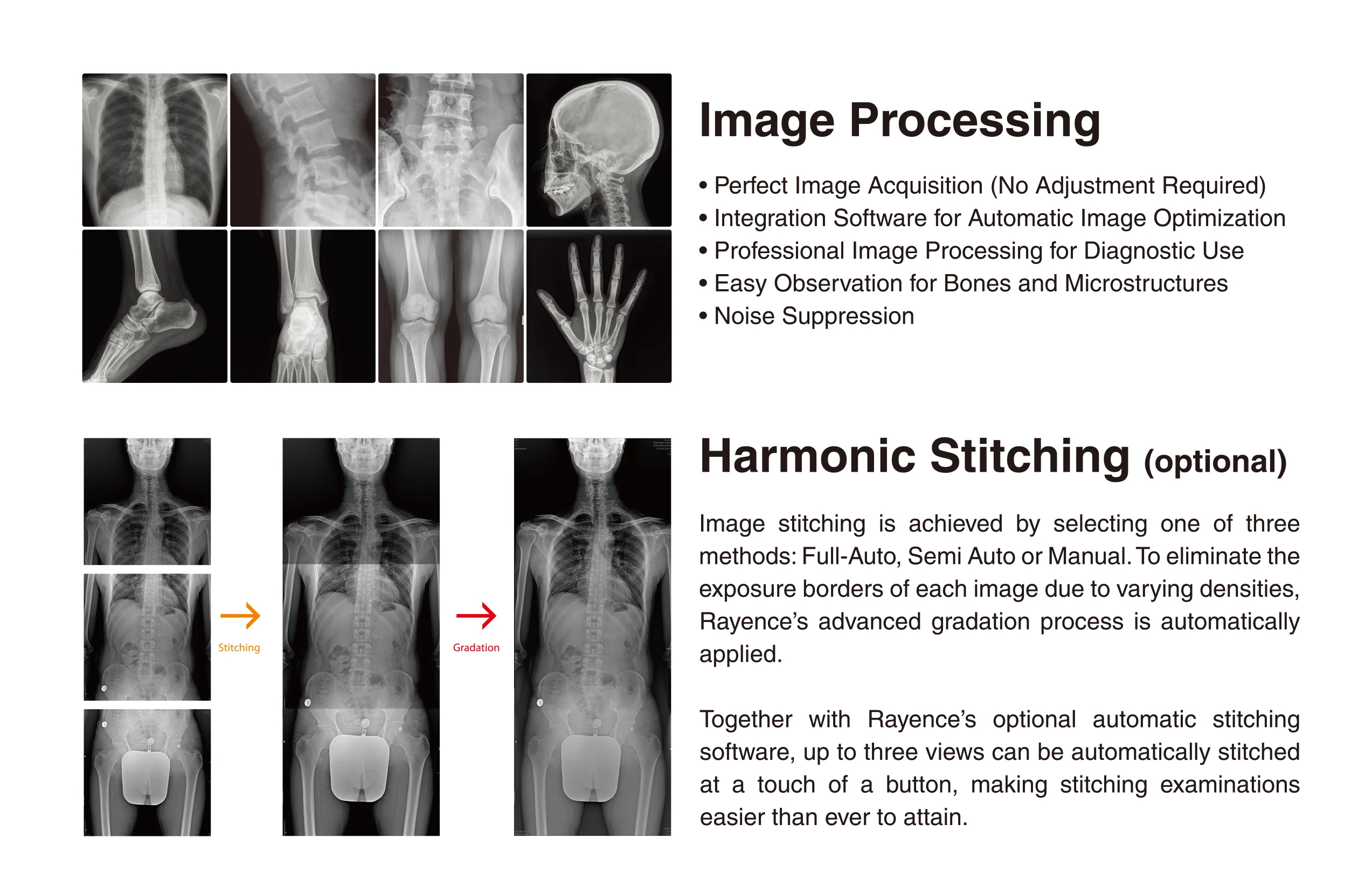 MSL DR Flat Panel Detector - GOS/CSI Wired 17x17 for Human and Vet Use