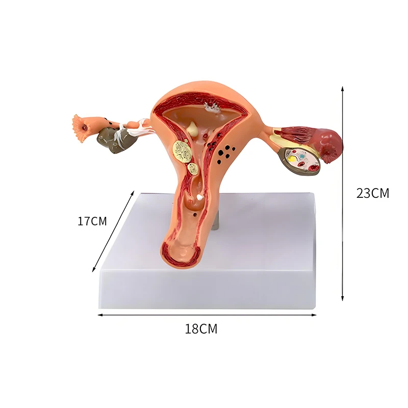 Human Anatomical Uterus Model - Realistic Medical Teaching Tool