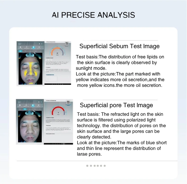 Cenmde Wood Lamp Skin Analyzer - Advanced Facial Diagnosis