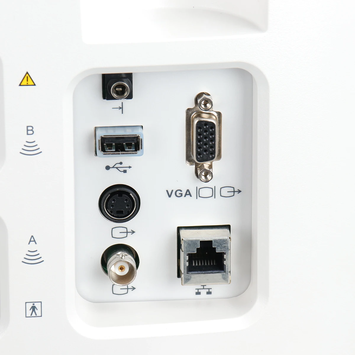 Mindray DP-10 Ultrasound - Advanced Diagnostic Imaging