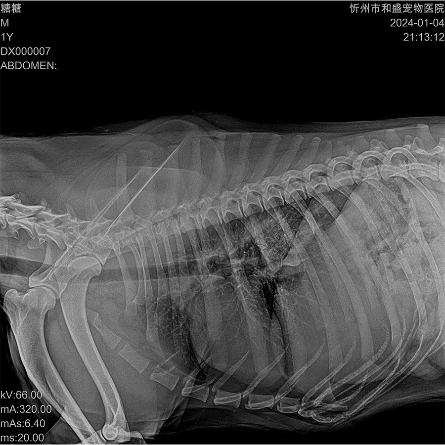 Cesium Iodide Careray Flat Panel Detector DR Machine X Ray for ...