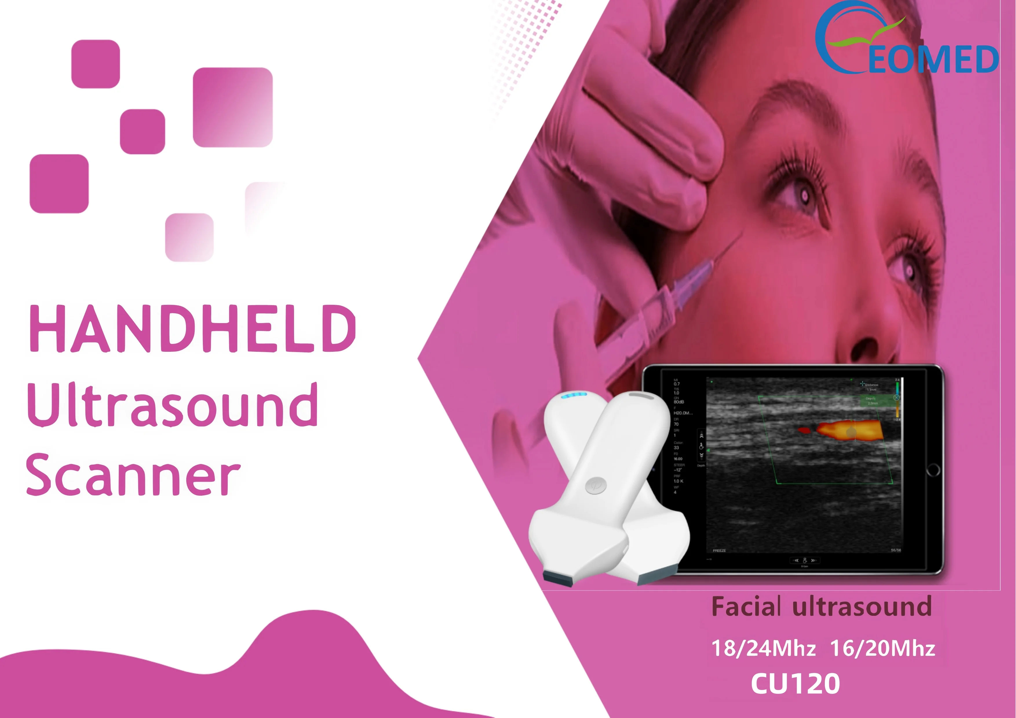 Lighter and Smaller Wireless Ultrasound CU120 Handheld Facial ...
