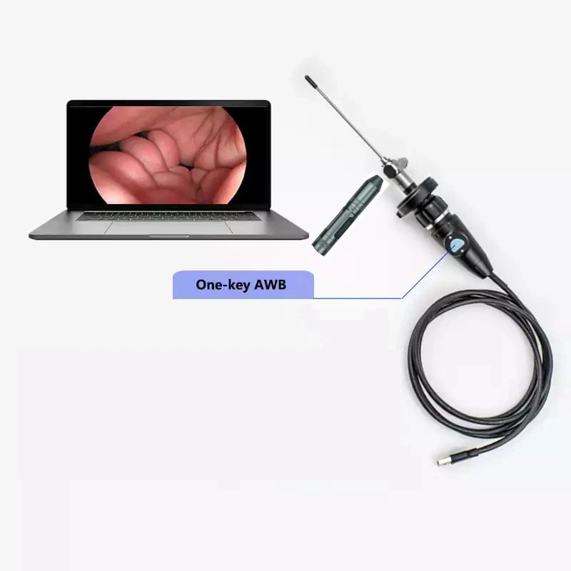 Portable Optical Adapter Medical Full HD Endoscope USB Camera Unit ...