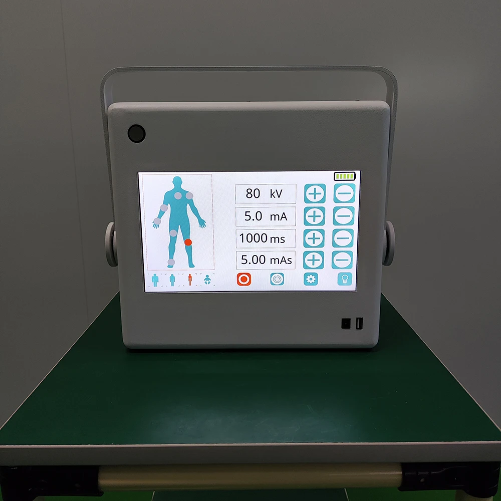 MSLGX23 Portable X Ray Machine with Remote Control - Efficient Digital ...