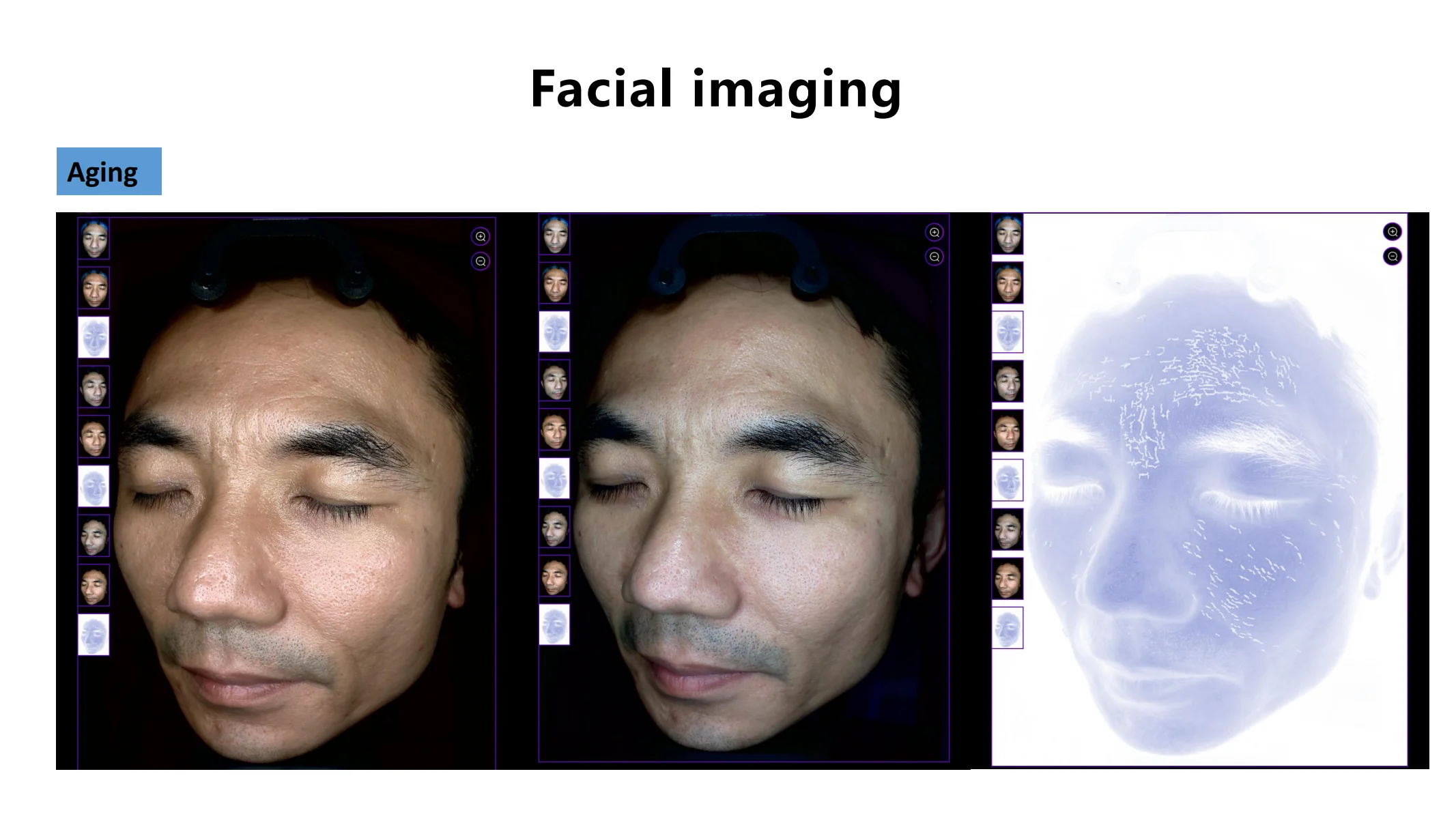Aisia AI Smart 3D Skin Detector - Advanced Face Analysis