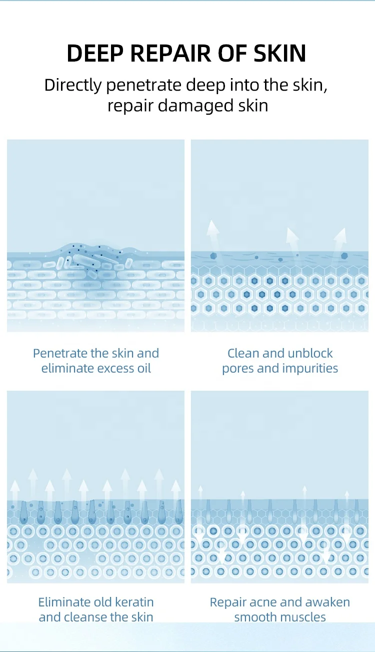 Salicylic Acid Acne Gel for Pimple Scar Removal - Shrink Pores & Smooth ...