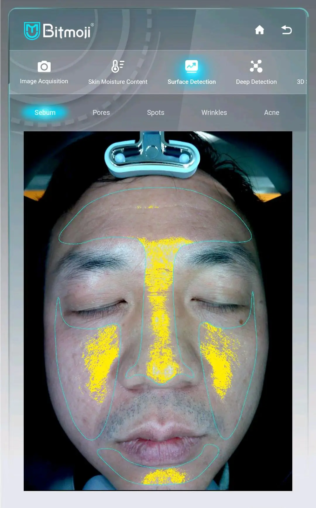2023 Moji Ai Skin Tester Max Version With Ipad Analyzer Face Skin Test ...