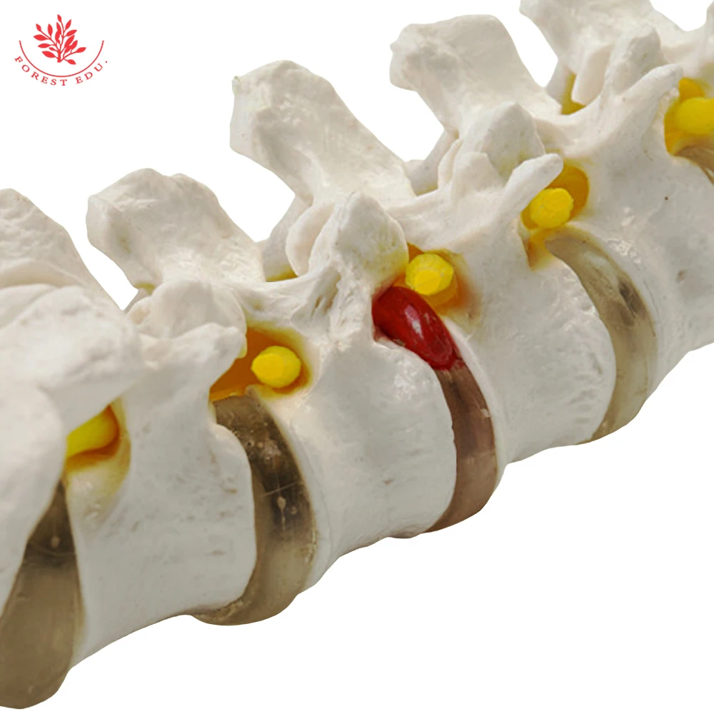 Medium-Sized Lumbar Spine Model Lumbar Vertebrae Include Sacrum ...