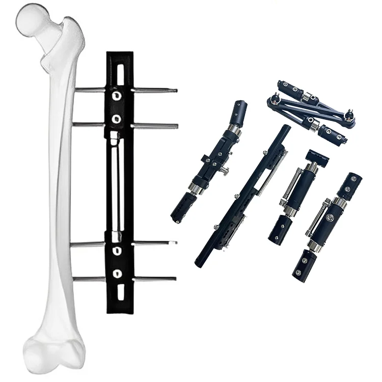 High Quality Orthopedic External Fixation Femur And Tibial External ...