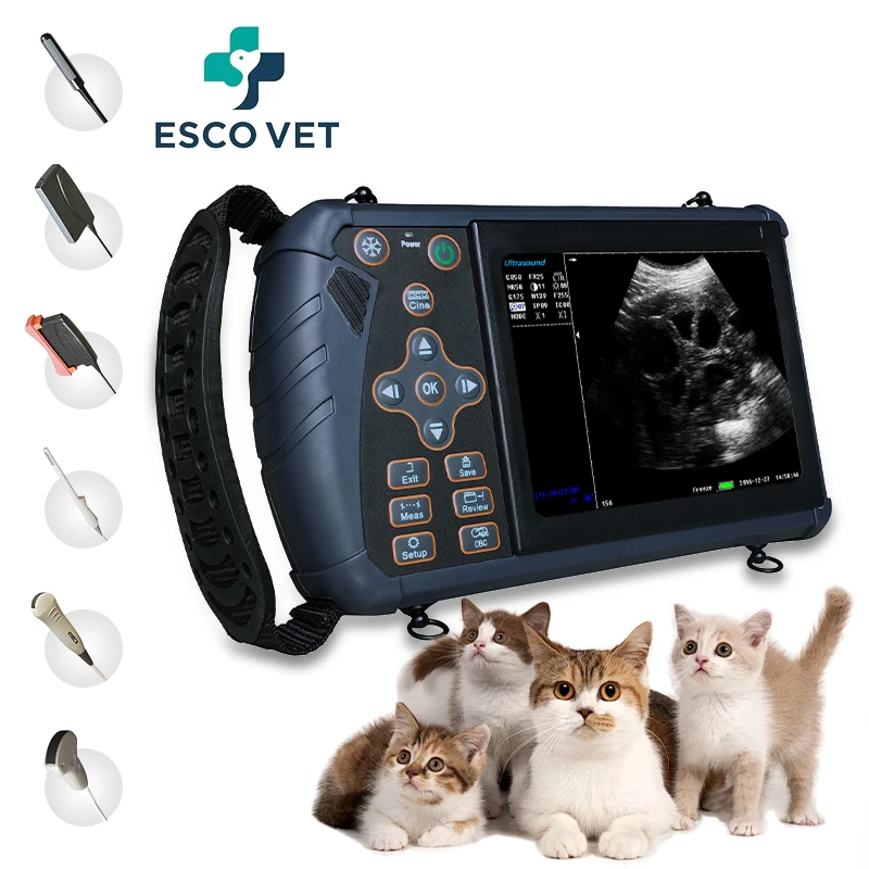 Renal Amyloidosis Scanner Small Intestine Layers Ibd Uterus Cystitis ...