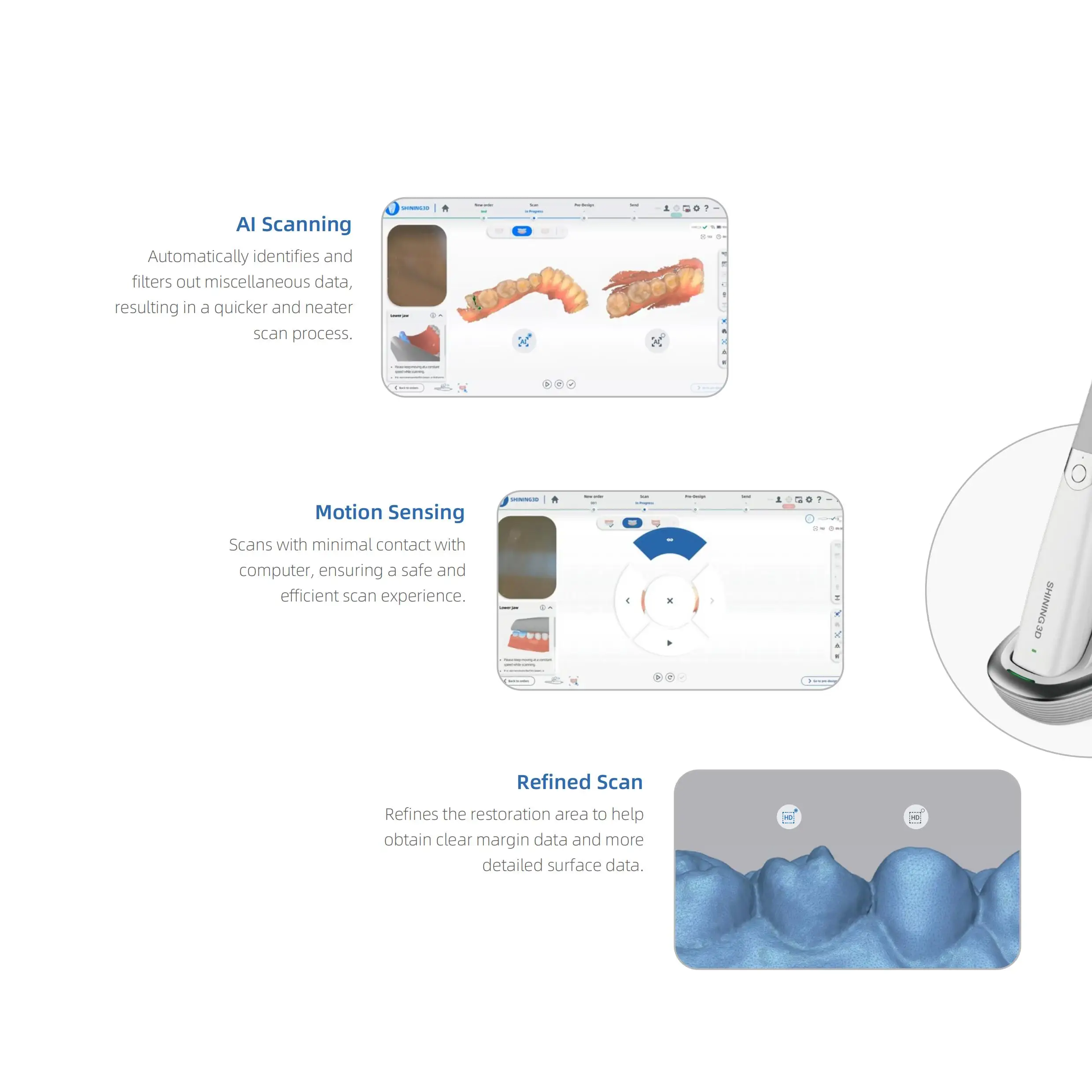 Shining Aoralscan 3 Wireless Digital Intraoral 3d Dental Scanner For ...