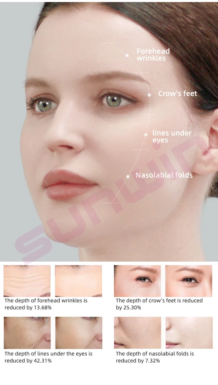 Professional Eye Face Probe Agemage Monopolar Thermal Fractional Rf