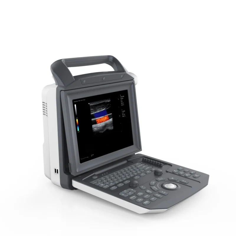 Continuous Color Doppler Ultrasound Equipment Ultrasonography - Buy Color Doppler continuous ...