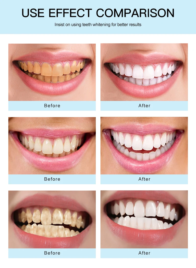 Whitening Toothpaste Tablets - High Quality & Convenient