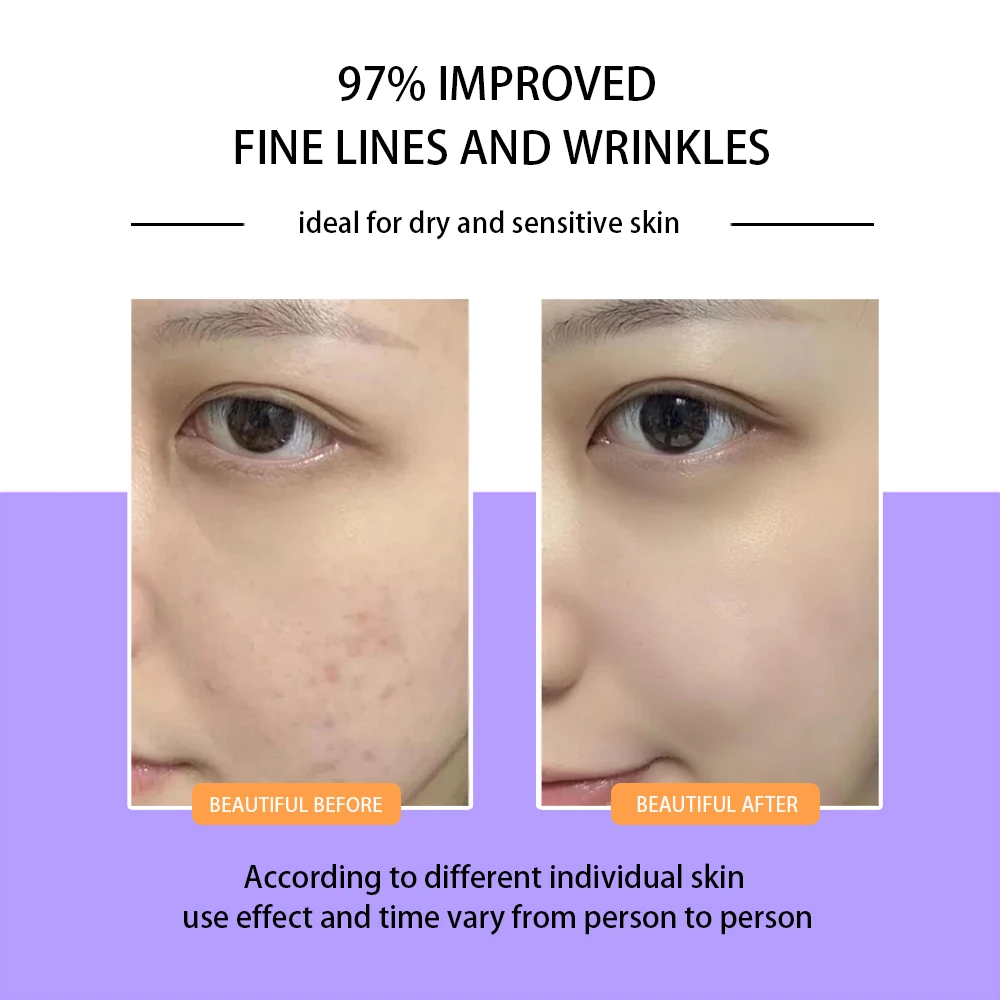 Private Label Custom Face Cream Whitening Anti Aging Wrinkle Sweet ...