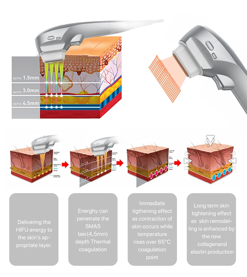 Ultramax 7D HIFU Beauty Machine Double Control 7 Cartridge for Body ...