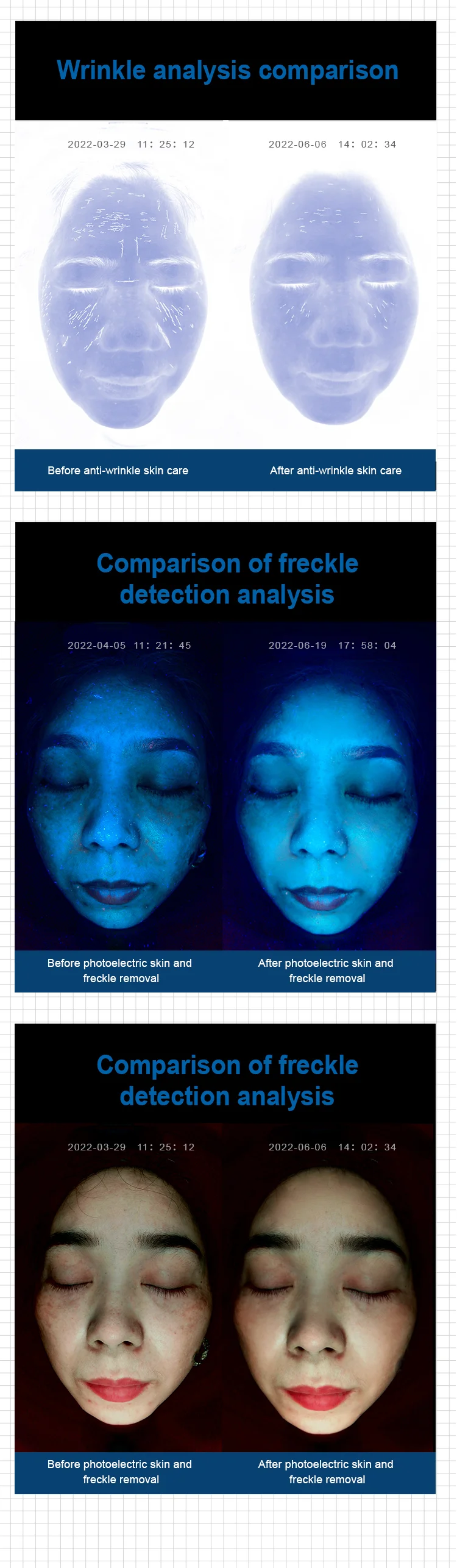 Professional Magic Mirror Aisia Facial Scanner 3d Skin Analysis System ...