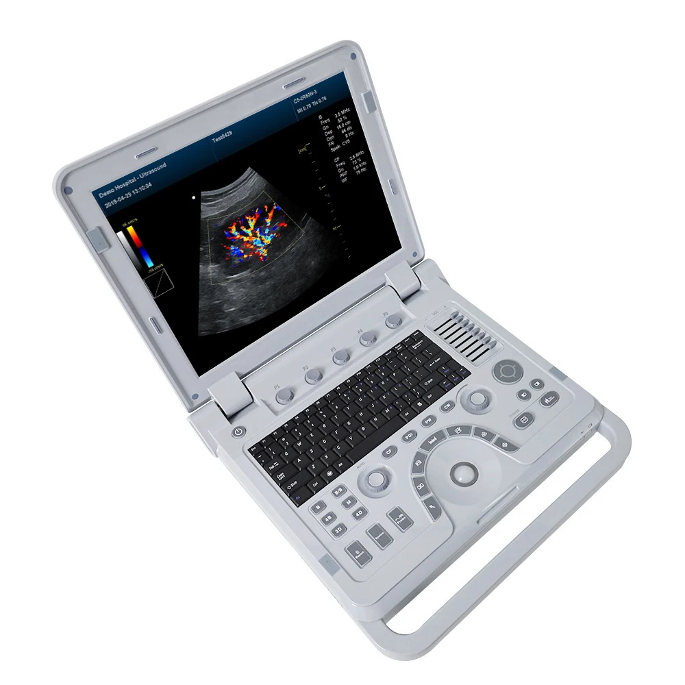 CONTEC CMS1700A cheap price medical ultrasound instruments ...