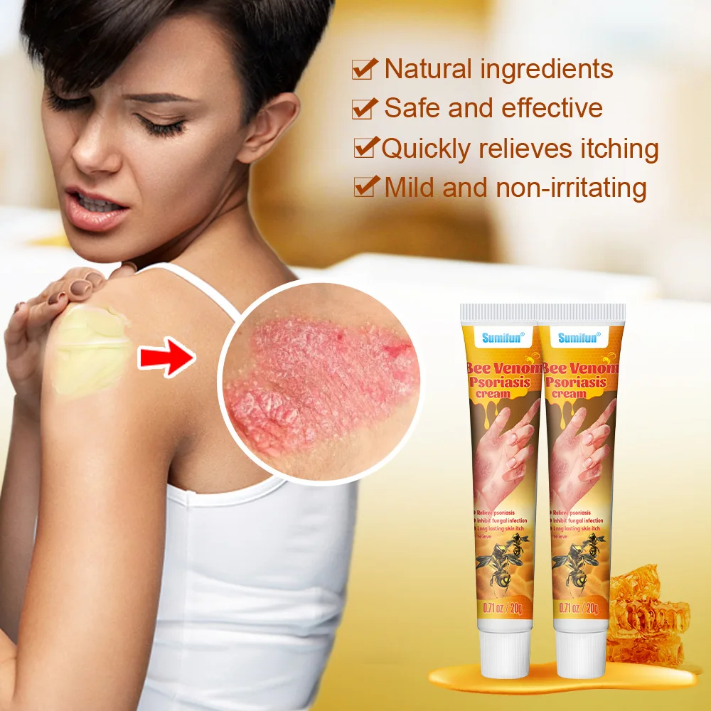 Wholesale 20g Fungal Infection Skin Psoriasis Creams Dermatitis Eczema Ointment Treatment ...