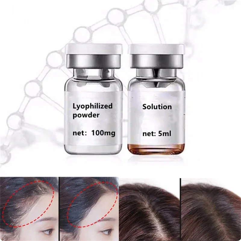 ZS EGF Anti-Hair Loss Regrowth Solution - Fast Results