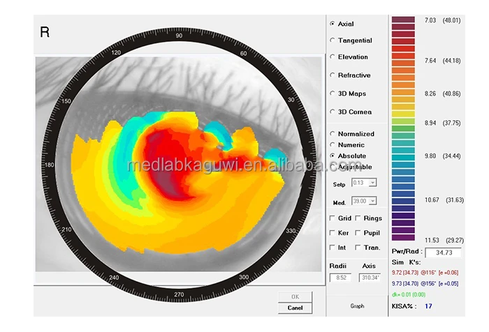 Corneal Topographer - Precision in Optometry & Ophthalmology