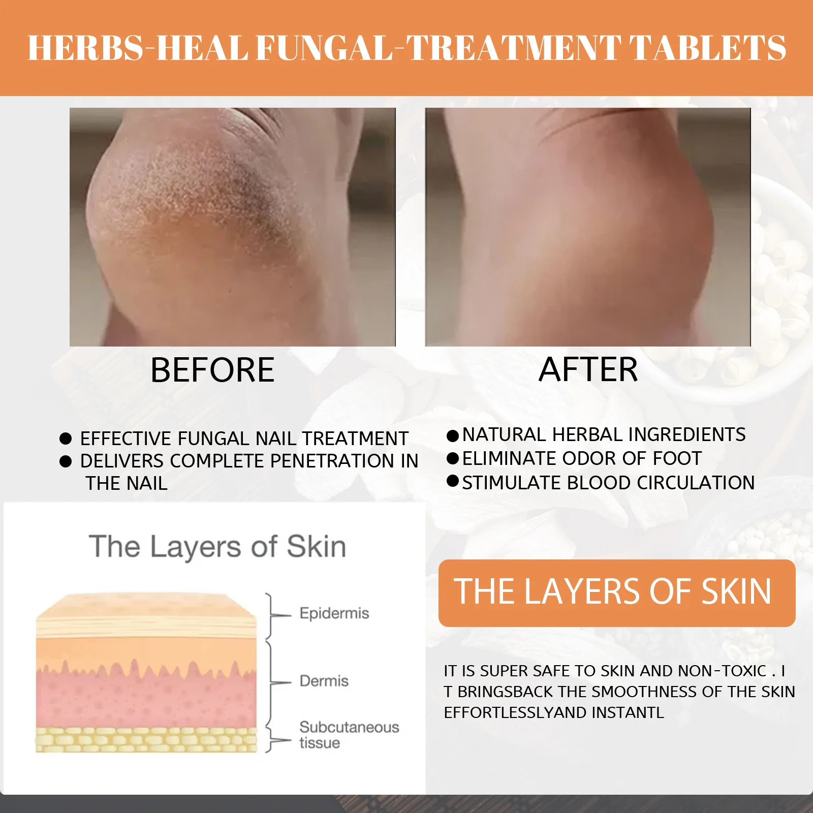 Eelhoe Ginger Anti-fungal Peeling Foot Soak Effervescent Tablets Foot ...