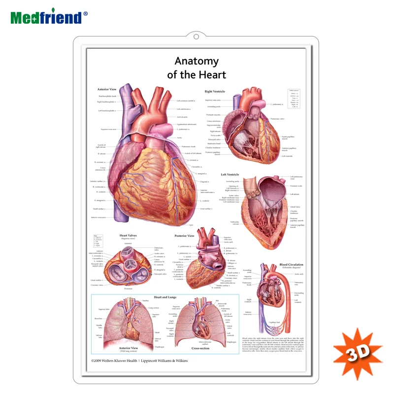 3D Medical Human Anatomical Wall Chart / Poster - Heart Disease ...