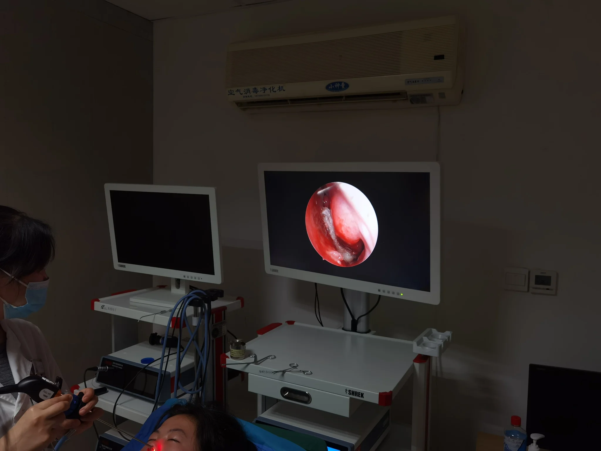 Shrek Endoscopy Portable Medical Endoscope Camera - 80W, 1920x1080 ...