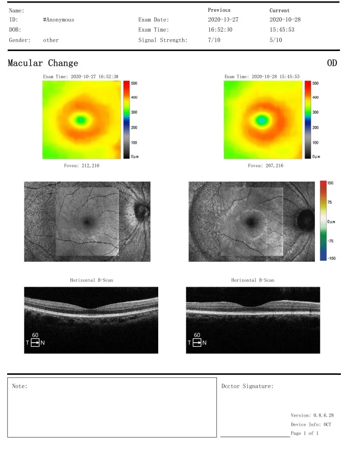 Ophthalmology Eye Ocular Coherence Tomography OCT-500