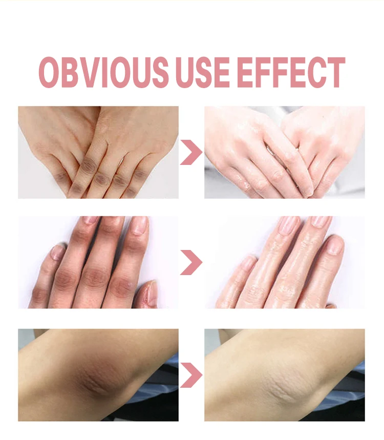 7 Day Dark Knuckles Whitening Serum - Smooth & Elastic Skin