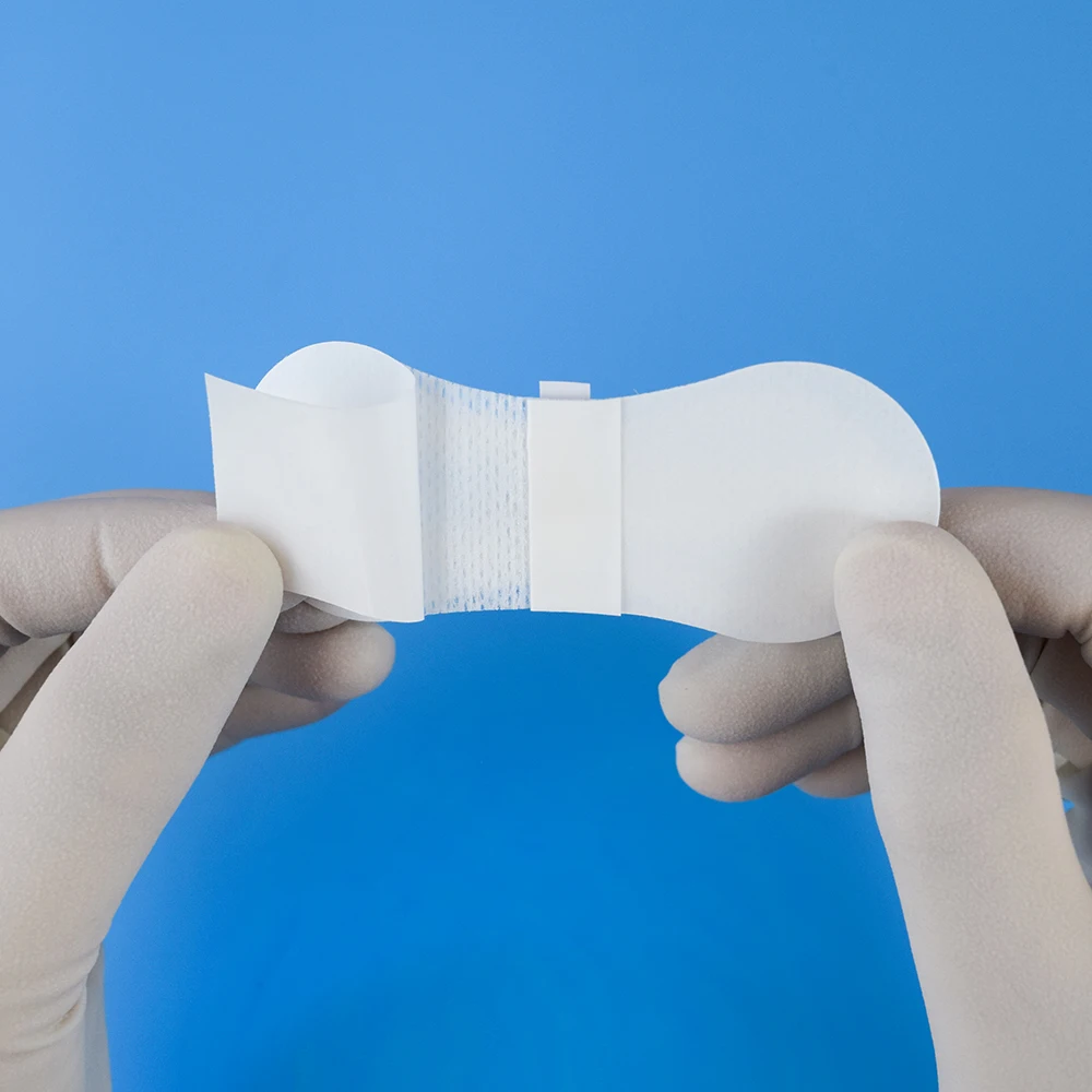 Catheter Fixation Device - Secure and Comfortable Solutions