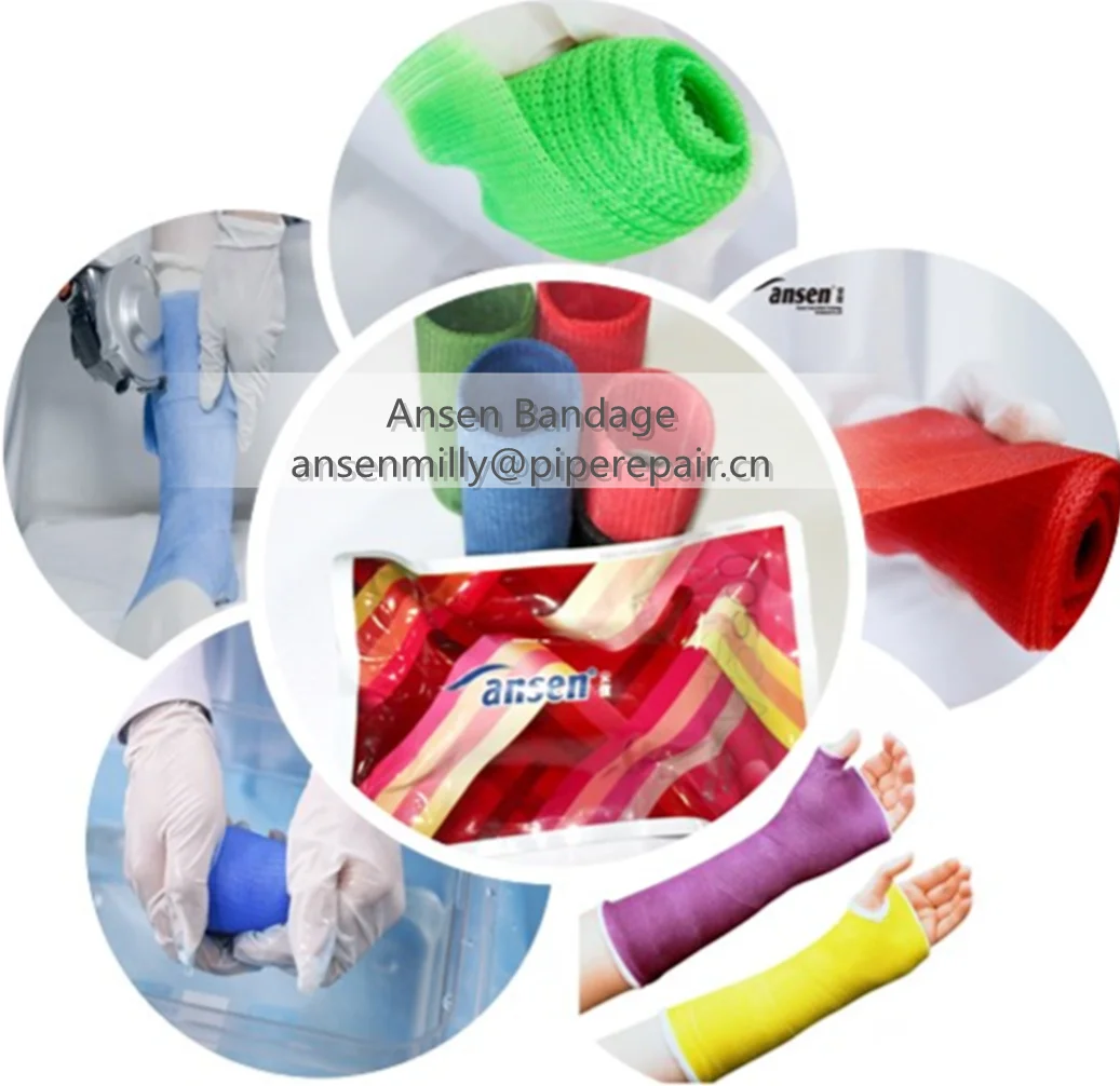 Hospital Disposable Items - Fibreglass Cast Medical Gypsum Bandage