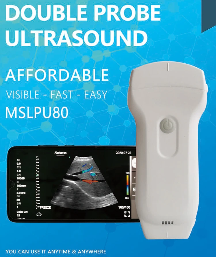 3 in 1 Linear Convex Double Probes - Portable Ultrasound