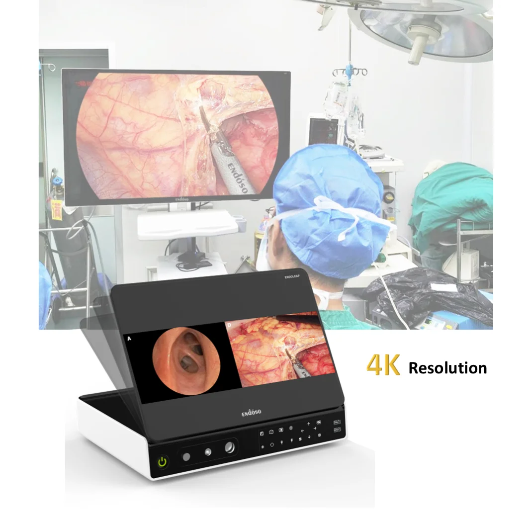 4K UHD Endoscope Camera System with Cold LED Light Source Laparoscopy ...