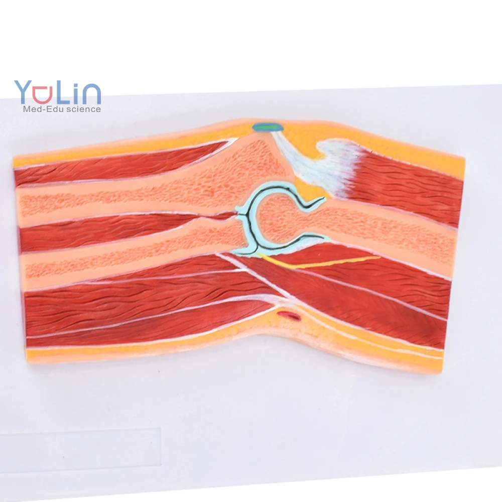 Human Section Through The Elbow Model Natural Size Medical Teaching ...