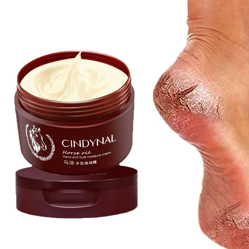 Anti Fungal Foot Repair Foot Cream Dead Skin Removal Peeling ...