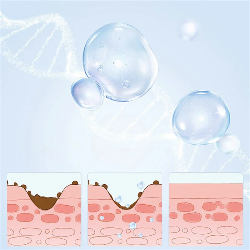 Fibronectin Freeze-Dried Powder - Acne & Scar Treatment