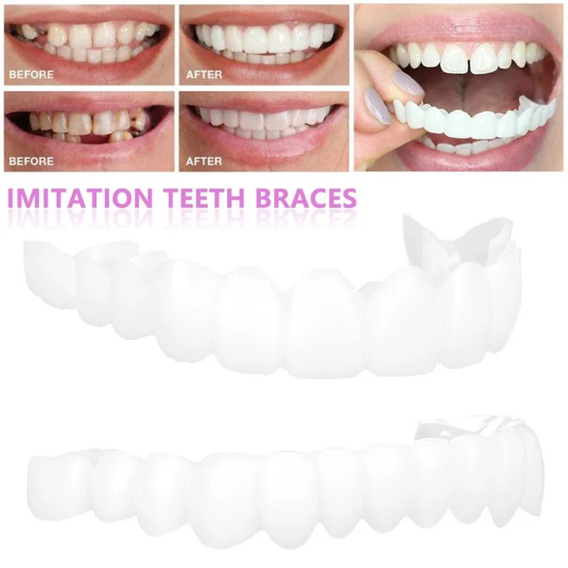 Teeth Veneers - Perfect Smile with Temporary False Teeth