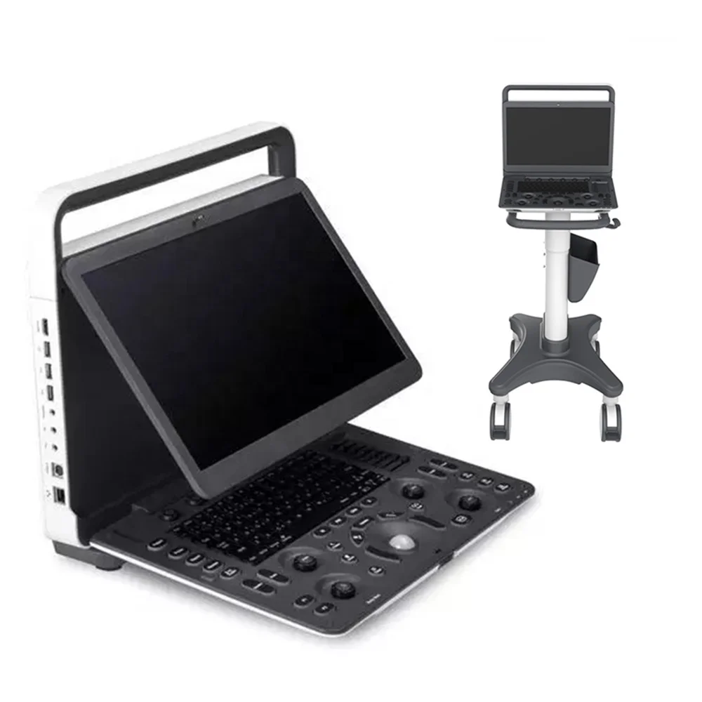 Sonoscape E2 Portable Color Doppler - Versatile Ultrasound